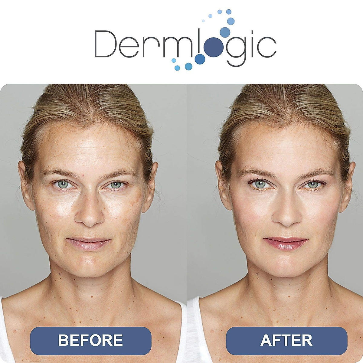 Dark Spot Corrector Cream- Visibly Fades & Repairs Marks from Dark Spots, Sunspots, Age Spots, Acne Scars, Brown Spots & Freckles for Face & Body. Safe for All Skin Types. 