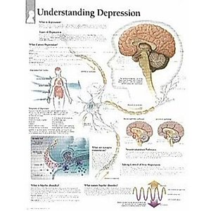 Understanding Depression chart: Wall Chart