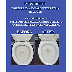Ring King Toilet Ring Remover, Toilet Bowl Ring Cleaner, Multi-Surface Calcium stain, Water Stain, Rust stain, Red clay stain, Lime stain remover, Fast Acting No Scrubbing