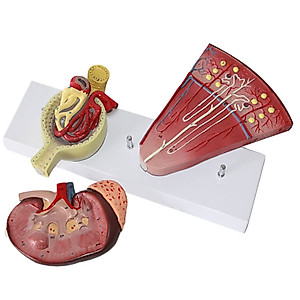Human Anatomy Kidney Model, glomerular Model Anatomical Biology Learning Set, Urinary System Anatomy Ornaments, Used in School Hospital Teaching Display Laboratory