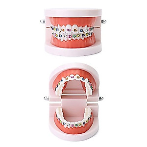 QWORK Typodonts Orthodontics Demonstration Model, Dental Tooth Research Model with Metal Wires and Ceramic Brackets, Teaching Teach Explanation Model for Adults