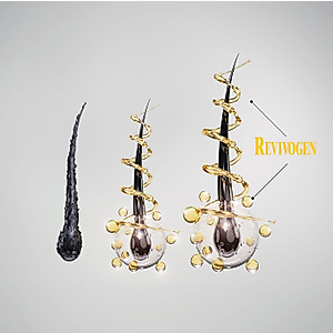 Revivogen MD Scalp Therapy Thinning Hair Solution and Bio-Cleansing Shampoo Set