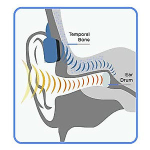 Seriously, No Bluetooth - Waterproof 8 GB Swimbuds Bone Conduction Bundle for Swimming with Music | Drag and Drop MP3, AAC, M4a, FLAC Using PC or Mac (No Spotify, or Other Streaming Services)