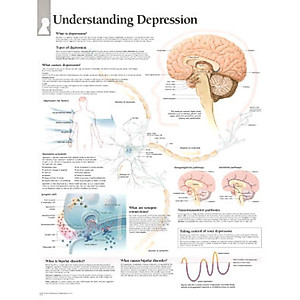 Understanding Depression chart: Wall Chart