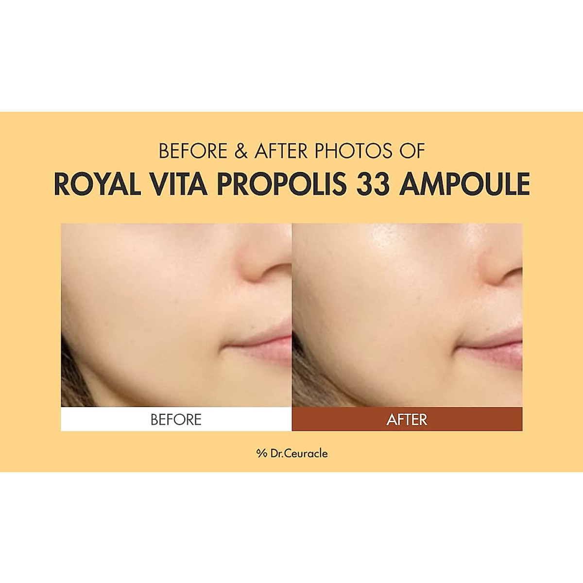 Honey Nourishing EssenceㅣRoyal Vita Propolis 33 AmpouleㅣKorean Skin Care Contains Royal Jelly Extract, PanthenolㅣEffective Vitamin Serum strengthen the skin Moisturizing, SoothingㅣDr.Ceuracle
