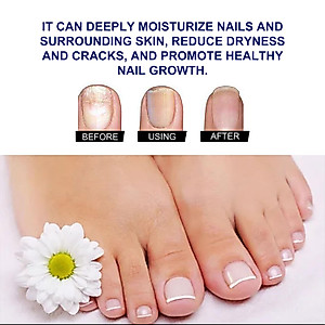 3 Bottles Plant Drops - Plant Drops for Nails Care (3 Bottles)