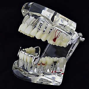 Vampire Half Grillz Fang Slim Silver Tone Bottom Lower Row Slugs Teeth Hip Hop Grills