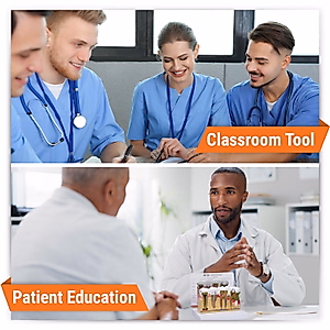 Dental Model | Human Body Anatomy Replica of Teeth w/Common Pathologies for Dentist Office Educational Tool | GPI Anatomicals