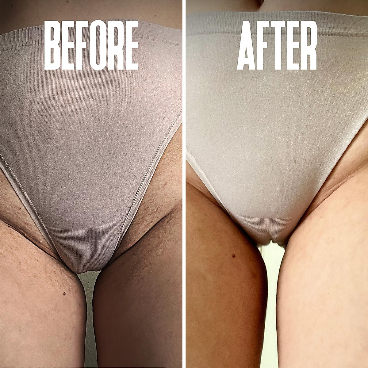 Prevent Ingrown Hairs and Razor Bumps with BHA & AHA Pads - Ingrown Hair Serum for Razor Burns - PFB Razor Bump Stopper Topicals Skin Care, Ingrown Hair Treatment for Bikini Area and Razor Bumps