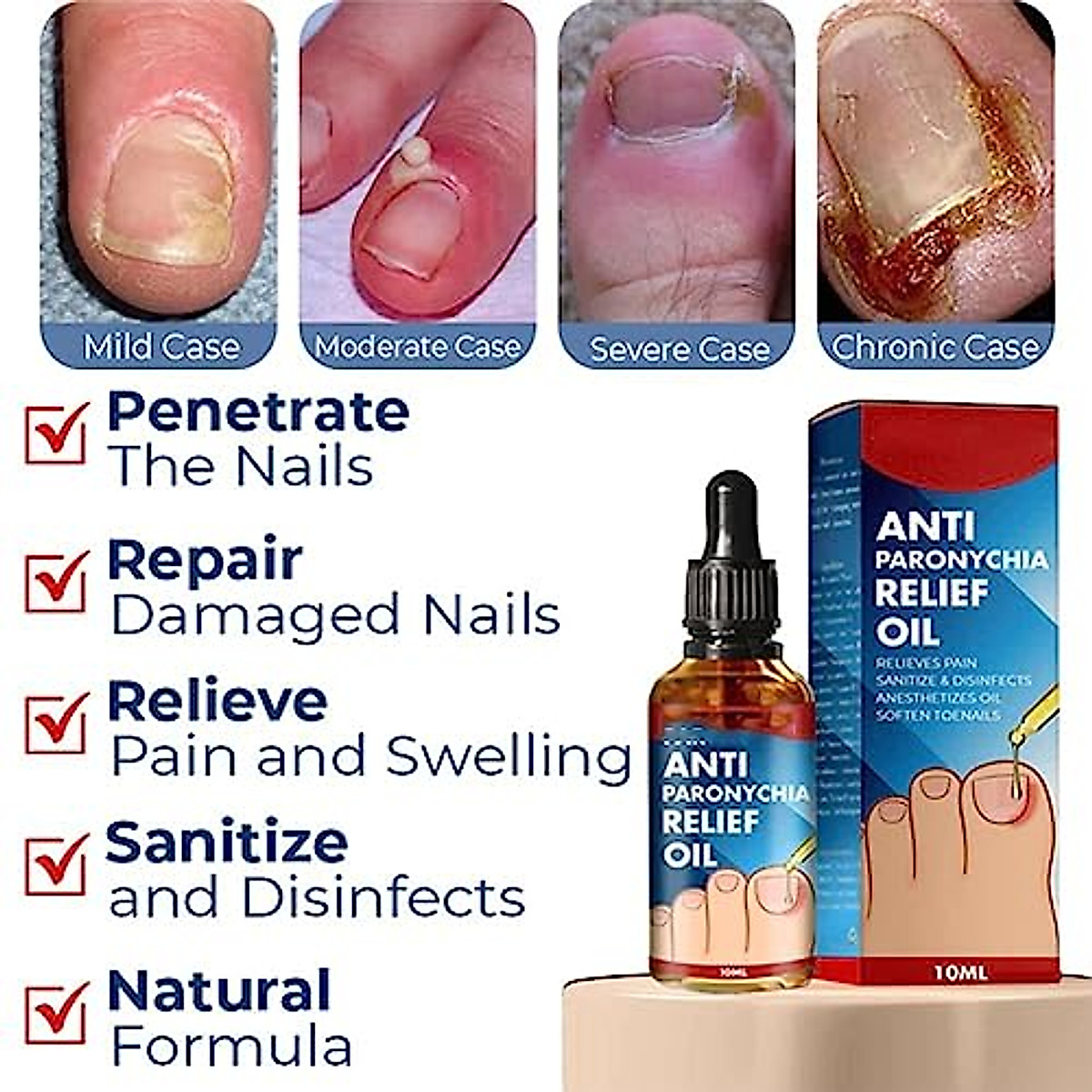2PCS German Toenailplus Anti Paronychia Relief Oil, Anti Paronychia Relief Oil, Toe and Fingernail Repair for Damaged Discolored Thick Nails