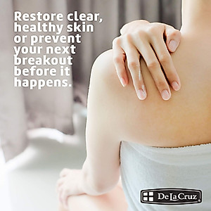 De La Cruz Sulfur Ointment - Cystic Acne Treatment for Face and Body - Daily 10 Min Spot Treatment Mask - Safe and Effective Game Changing Hormonal Acne Treatment that Clears Up Pimples - 2.6 OZ