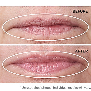StriVectin Anti-Wrinkle Double Fix for Lips Plump and Smooth Vertical Lines, Hydrating Two-in-One Treatment, 0.16 Fl O