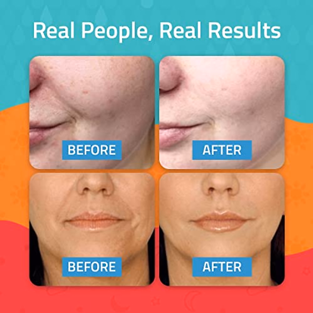 Retinol Serum for Face, Hyaluronic Acid Serum for Face, Vitamin C Serum for Face, Facial Serums, Anti Aging Serum, Face Serum for Women, Hydrating & Wrinkle Serums 3x1 fl Oz, Skincare Set By YEOUTH