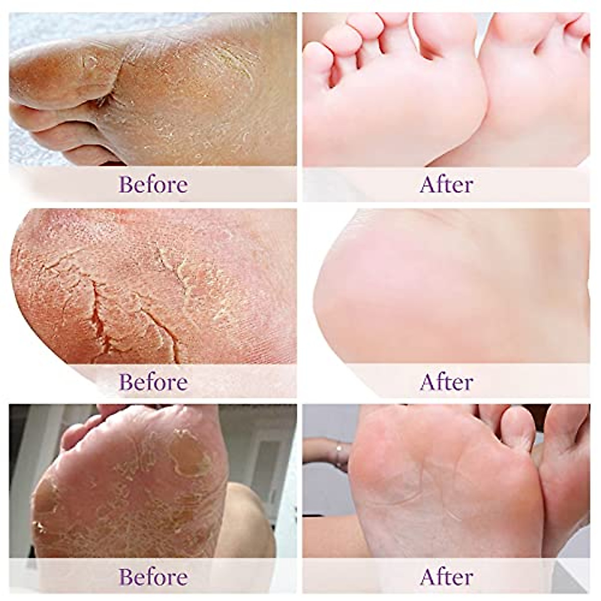 WEIDA SIGN Foot Peel Mask 3 Pack,For Cracked Heels, Dead Skin & Calluses - Exfoliator Remove Repair Rough Heels,Make Your Feet Baby Soft & Get a Smooth Skin (Lavender)