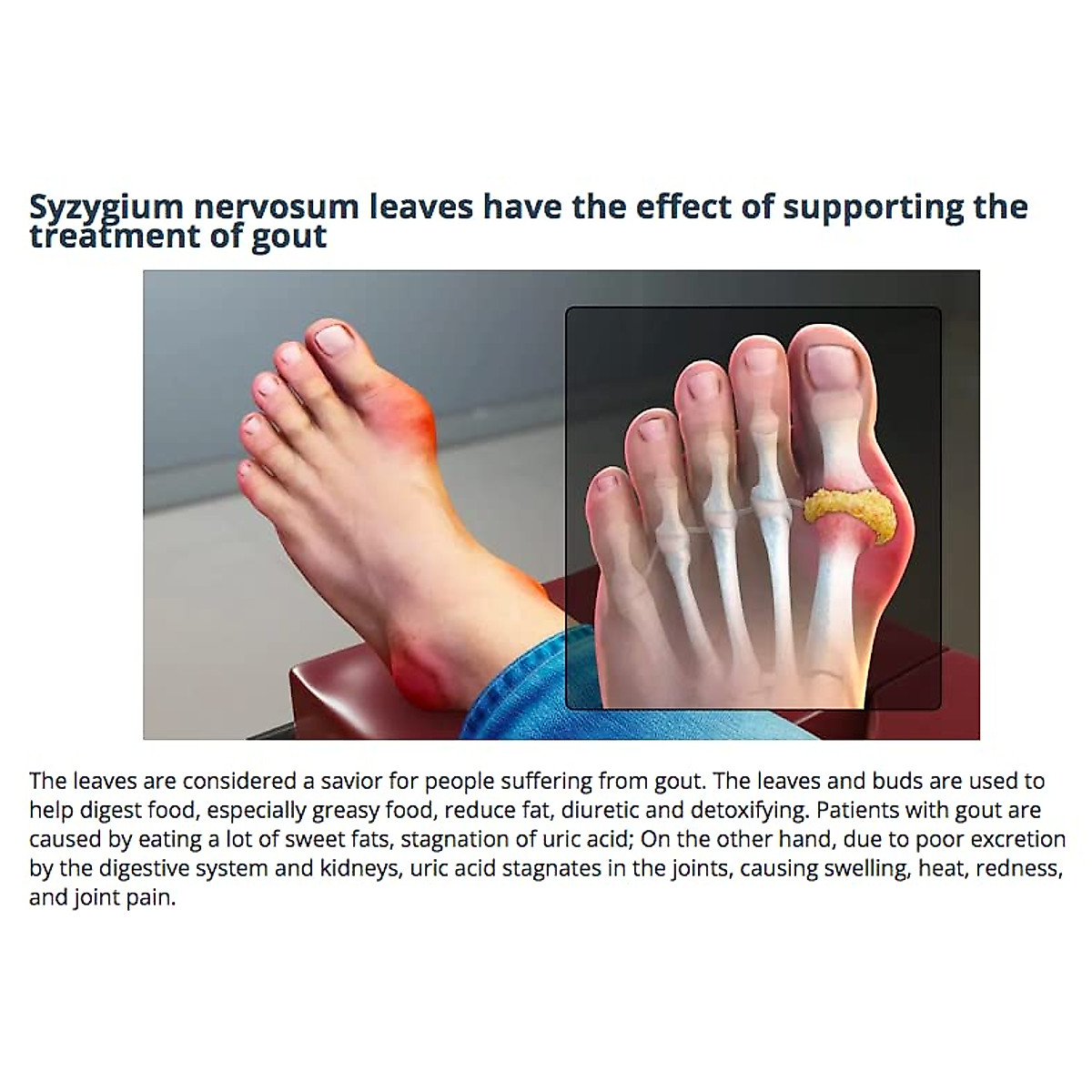 Nu Voi Herbal Tea 100 Gram Syzygium Nervosum Tea Cleistocalyx Operculatus C. Nervosum for Antioxidants, Skin Health, Stress Relief, Boost Energy, Immune System