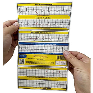 R-CAT for Arrhythmias EKG Pocket Reference Guide – Great Study Card for EKG Interpretation - ACLS and PALS Training – Cardiac Rhythm Interpretation Made Easy