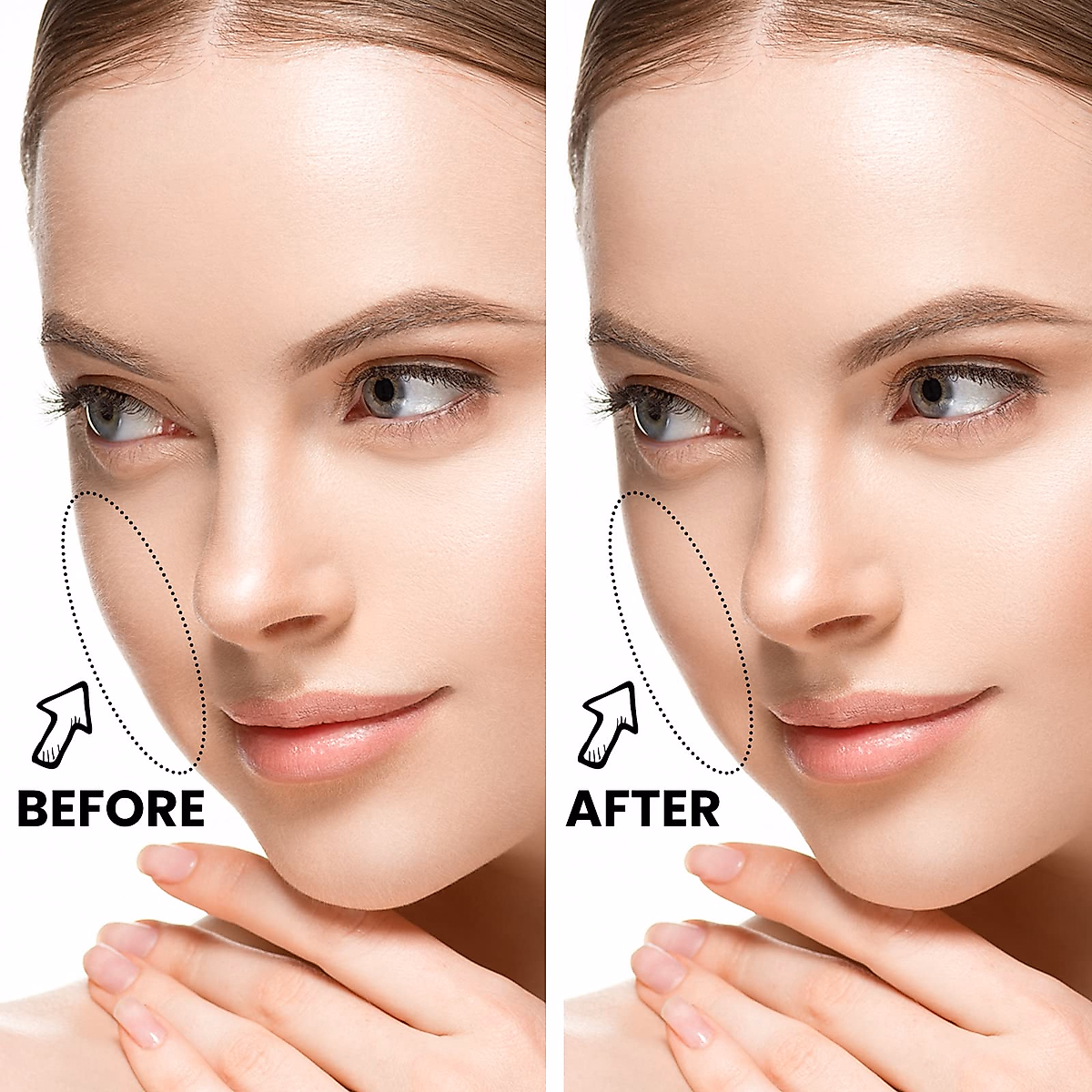 OPOVE Dermaplaning Tool Set,Professional Dermaplane Tools with 6 Refill Blades,Peach Fuzz Removal & Eyebrow Shaper–Face Shavers for Women,Facial Hair Razor Help Exfoliate and Smooth the Skin-Champagne