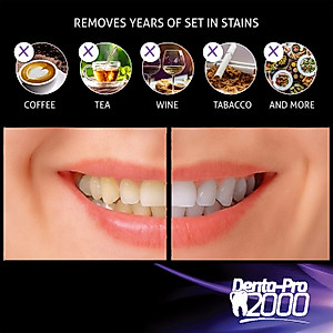 At Home Deluxe 3D Teeth Whitening Premium Kit By DentaPro2000 - If you Want Immediate Results This Is The kit To Use!