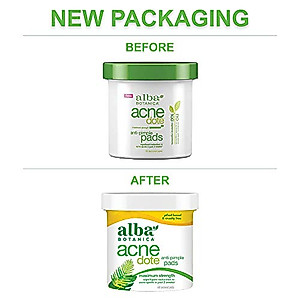Alba Botanica AcneDote Anti-Pimple Pads, 60 Count (Packaging May Vary)