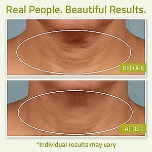 YEOUTH Neck Cream with Vitamin C, Moisturizing Neck Firming Cream for Women and Men, Targeting Decolletage and Double Chin, Cleavage and Chest 4oz