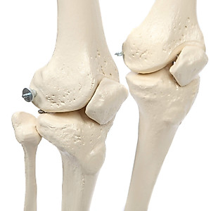 Rudiger Anatomie Physiological Skeleton with Flexible Spine, Spinal Cord, Vertebral Arteries, Mounted Herniated Disc and Sectioned Sacrum, Includes Display Stand with Casters, Dust Cover, and Warranty