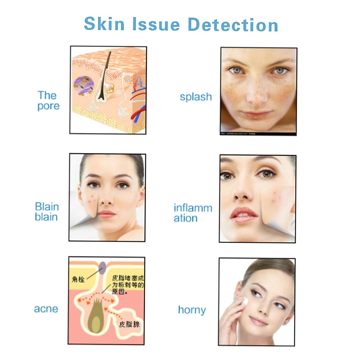 [USB Endoscope Camera] 500X Digital Microscope for Scalp & Skin Analysis - Hair Follicle Detector & Beauty Skin Analyzer - High-Resolution Imaging & Skin Testing with Software Compatible