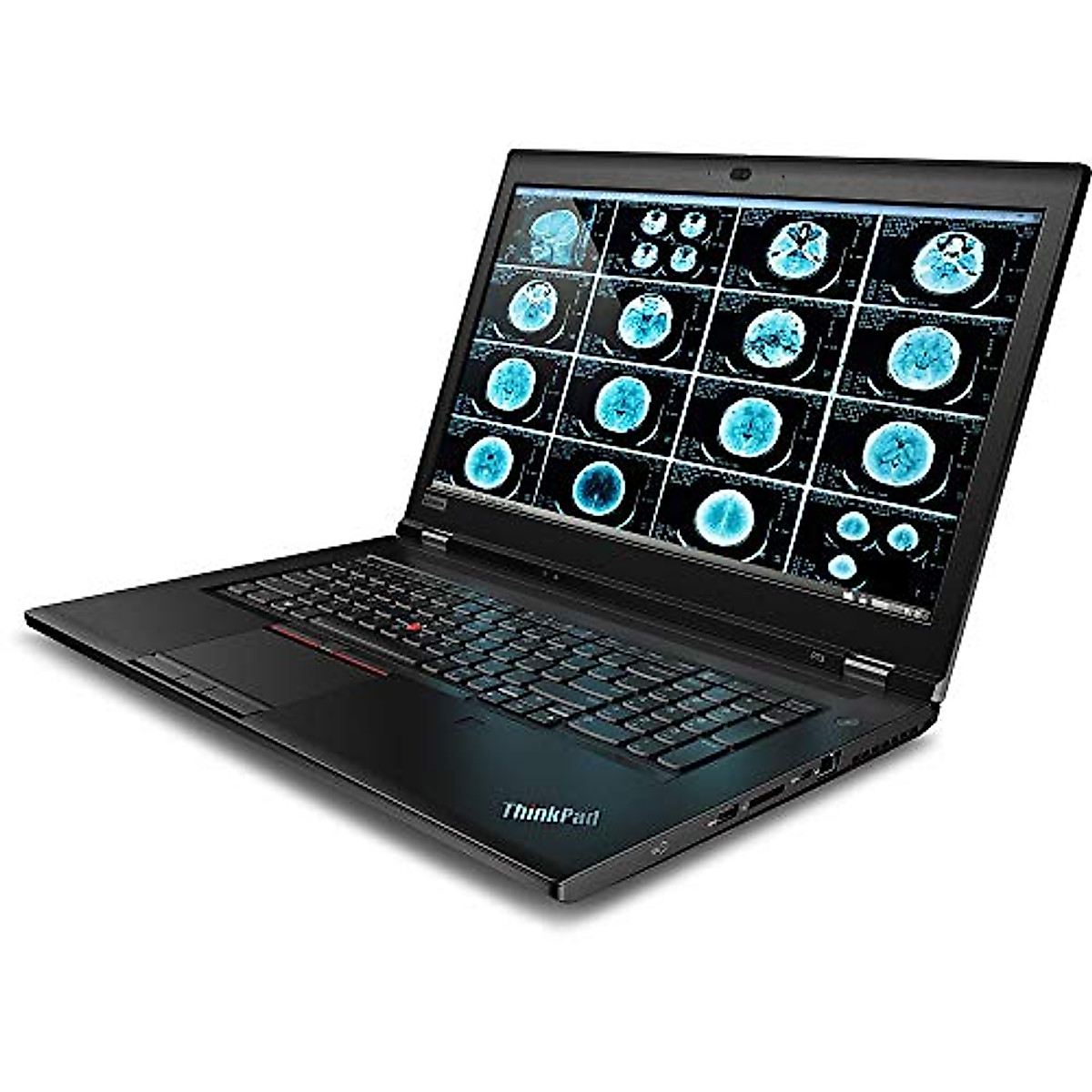 Lenovo ThinkPad P73 Workstation Laptop (Intel i7-9750H 6-Core, 32GB RAM, 1TB SATA SSD, Quadro P620, 17.3" Full HD (1920x1080), Fingerprint, 3xUSB 3.1, 1xHDMI, Win 10 Pro) with USB3.0 Hub
