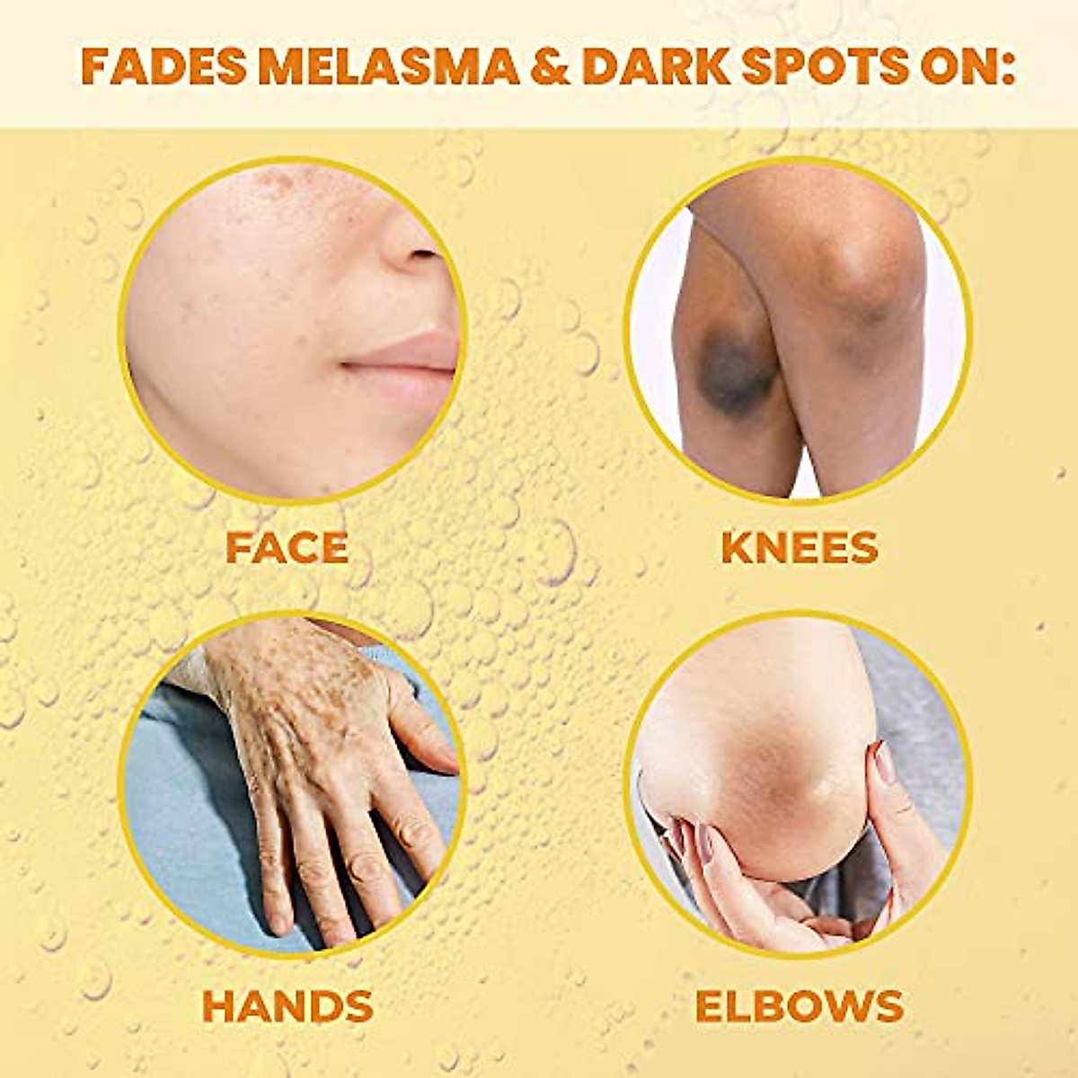 CAROTÏS, Skin Brightening Serum | 1 fl oz / 30 ml | Helps to Remove Dark Circles, Wrinkles & Spots, with Carrot Oil and Vitamin A