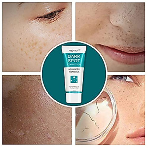 Dark Spot Remover for Face, Dark Spot Corrector Cream, Fade Out The Skin Black Precipitate, Remove Freckle for Face, Fade Spots for All Skin Tone Types