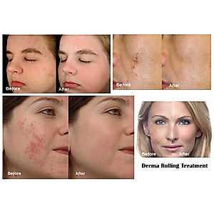 Copper Peptide Serum With Swiss Apple Stem Cell Boosts Collagen Production. Ideal Result Working with Derma Roller.