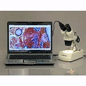 AmScope SE305R-PZ-LED Forward-Mounted Binocular Stereo Microscope, WF10x and WF20x Eyepieces, 10X/20X/30X/60X Magnification, 1X and 3X Objectives, Upper and Lower LED Lighting, Reversible Black/White Stage Plate, Pillar Stand, 120V or Battery-Powered