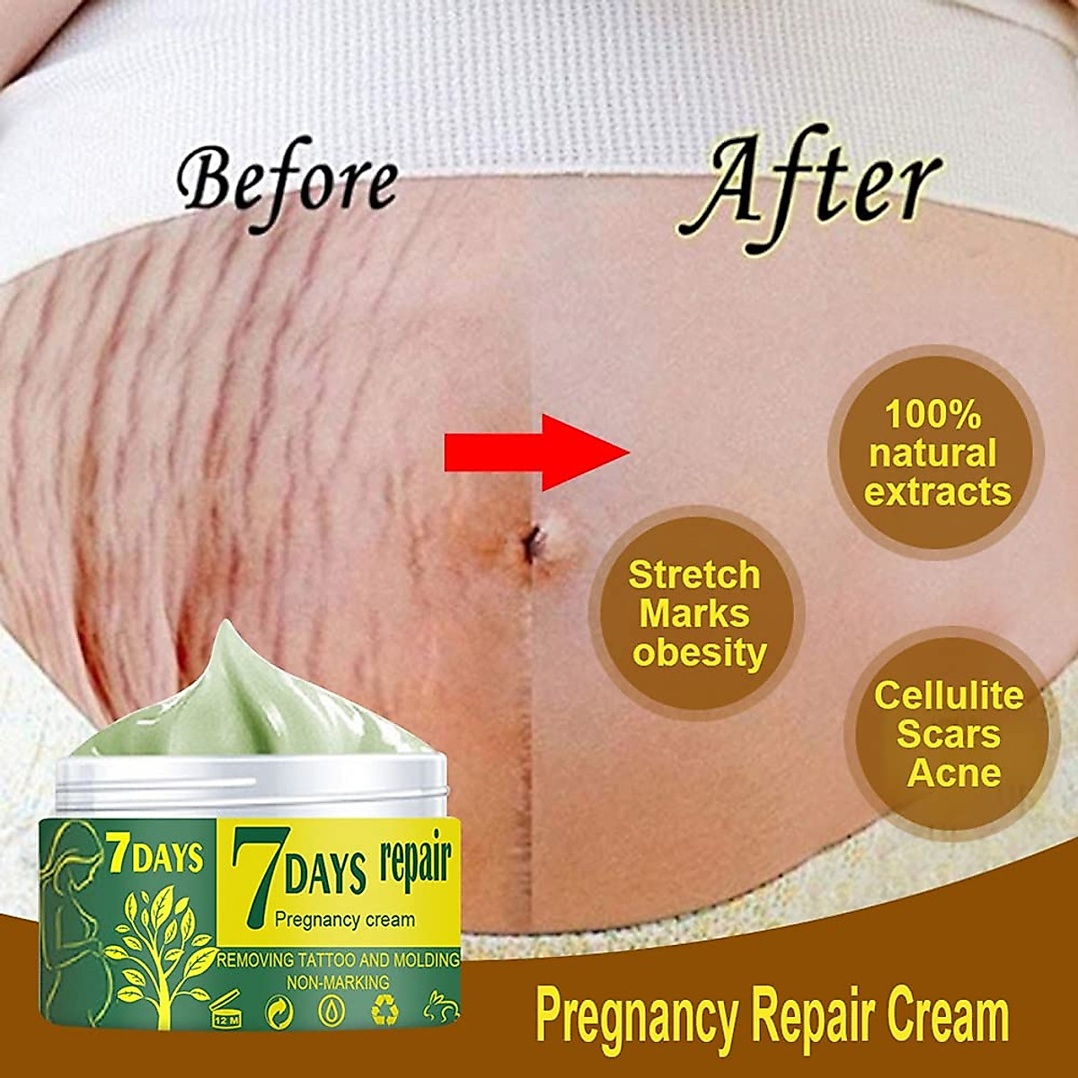Hotiary Maternity Stretch Mark 7 Days Repair Cream Removing Tatoo Molding Non-marking Pregnancy Obesity Skin Postpartum Stretch Scar Body Marks Remover Smooth Skin Care 1.67 oz