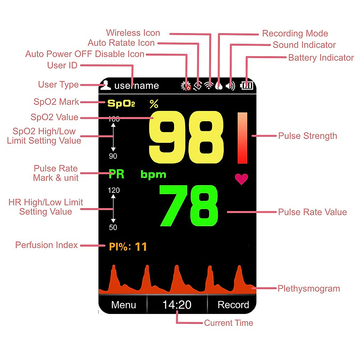 Viatom Handheld Pulse Oximeter for Adults, Up to 580 Hours of Storage Data Accurate SpO2 & Pulse Rate