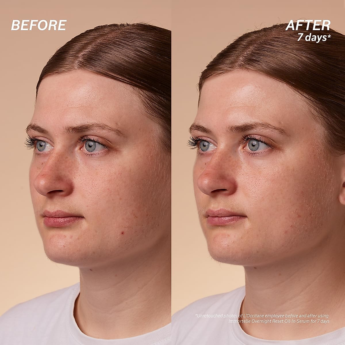 L'OCCITANE Immortelle Overnight Reset Oil-In-Serum: More Radiant Skin In 1 Night, Smooth Fine Lines, Revitalize Dull Skin, Award-Winner, With Immortelle Essential Oil, 1.6 Fl. Oz