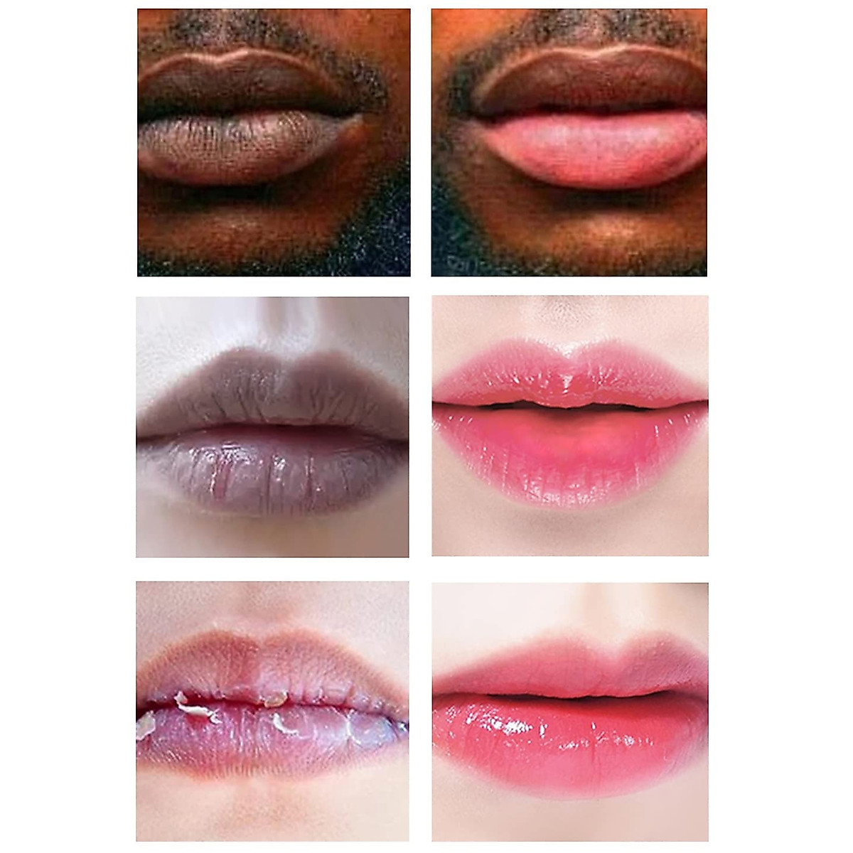 H.D.S.N. Lip Scrub For Dry Lips 20g - Lighten Dark Lips For Smoking Men Women Smoker | Natural Balm Moisturizer Exfoliator Sleeping 0.7 Fl Oz (Pack of 1)