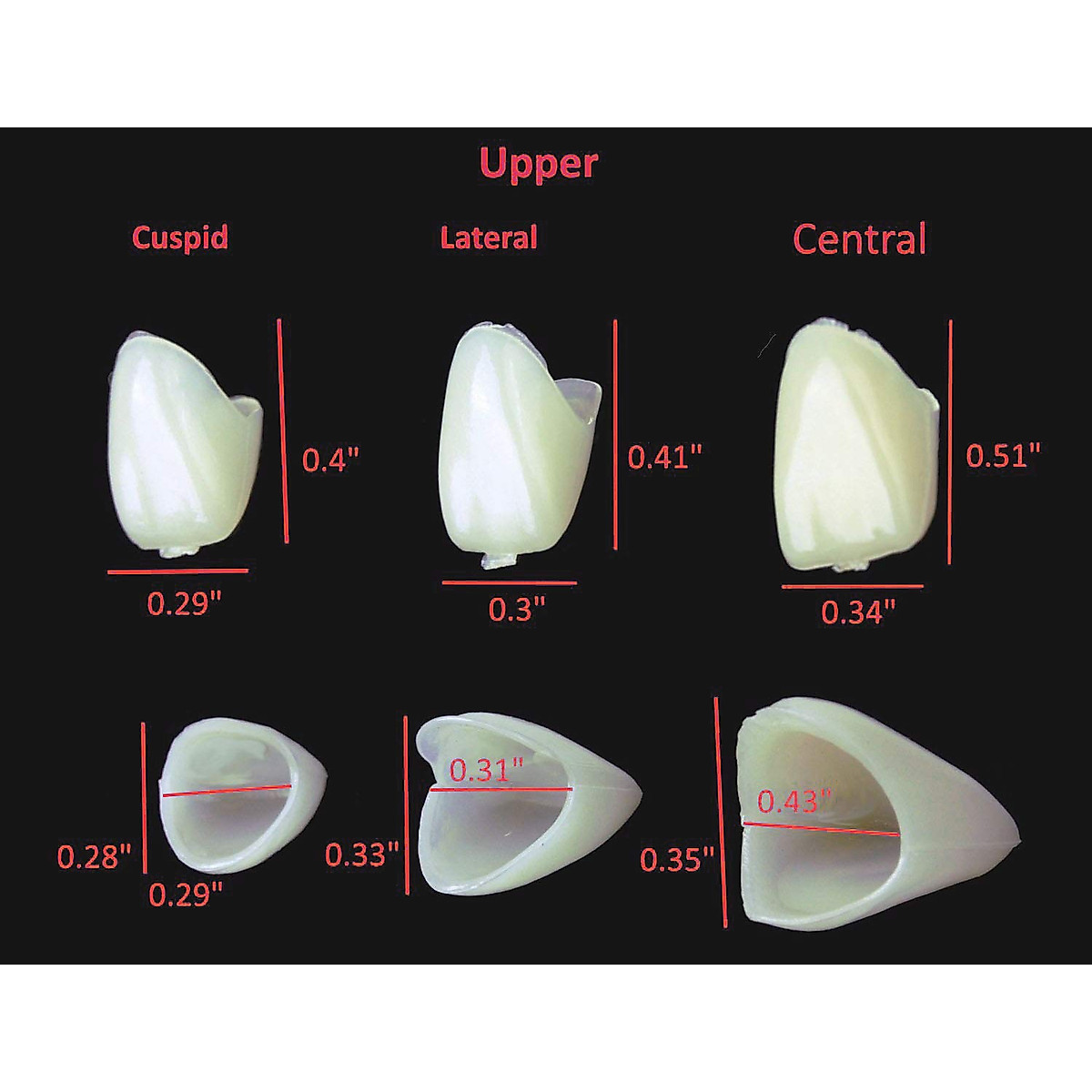 Temporary Tooth Crown Fake Teeth Repair Material Front & Molar Posterior offering Help in Fixing Missing Broken Tooth (2 boxes around 100 pcs)
