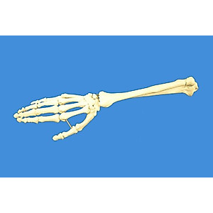Wellden Product Anatomical Human Right Hand with Ulna and Radius Skeleton Model, Life Size
