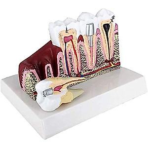 KEZaiZHe Anatomy Education Model - Teeth Cross-Section Model - Gums Model Anatomy Teeth Model Detachable Education Dental Model - for Study Display Teaching Medical Model