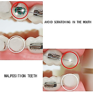 RZJZGZ Dental Oral Care Orthodontics Wax with Fruit Smell for Brace Wearers Flavored Gum Protection (3Pack)