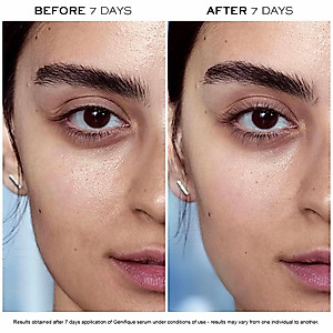 Lancôme Advanced Génifique Radiance Boosting Anti-Aging Face Serum - Visibly Hydrates & Plumps Skin - with Bifidus Prebiotic, Hyaluronic Acid & Vitamin Cg, 1.7 Fl Oz