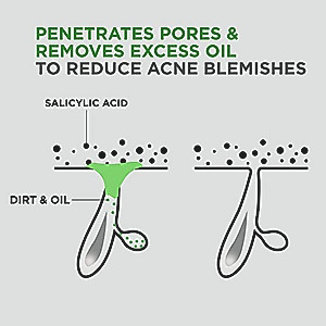 DOVE MEN + CARE Advanced Care Cleanser Acne Clear 3 Count for Acne Prone Skin Face + Body Cleanser with 1% Salicylic Acid 16.9 oz