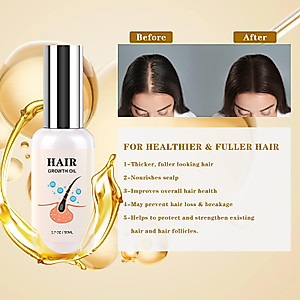 Hair Growth Oil - Rice Water For Hair Growth For Women & Men, Hair Loss Treatments, Serum For Thicker Longer Fuller Healthier Hair, Biotin & Castor Oil & Rosemary Oil 50ml