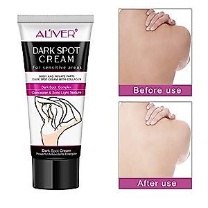 Dark Spot Cream, Natural Underarm Cream, Dark Spot Cream Corrector for Neck and Dark Spots, Sun Spots, Age Spots, Hyperpigmentation, Even Sensitive Skin-Instant Result