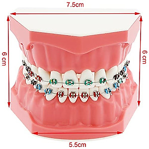 Dentalmall Typodonts Orthodontics Demonstration Model with Metal Wires and Bracket Teaching, Learning, Interpretation Model for Adults and Children (Metal Bracket)