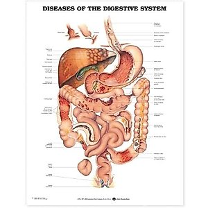 Diseases of The Digestive System Anatomical Chart