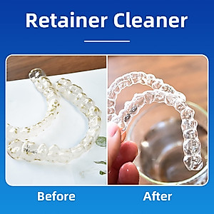 PROJECT BETTER Retainer Cleaner Tablets & Denture Cleaning Tablets for Dental Appliances and Night & Mouth Guard.(36 Counts