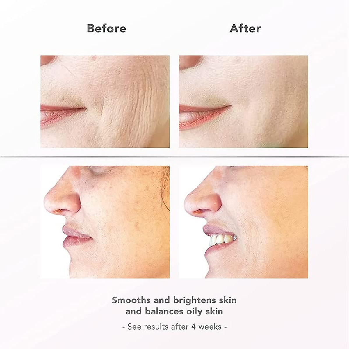 AURA Light Therapy Mask - Soft and Light-Weight - Latest 4 Colors LED Face Mask Light Therapy to Address Different Skin Care Needs - Beauty & Personal Care at the Comfort of Your Home