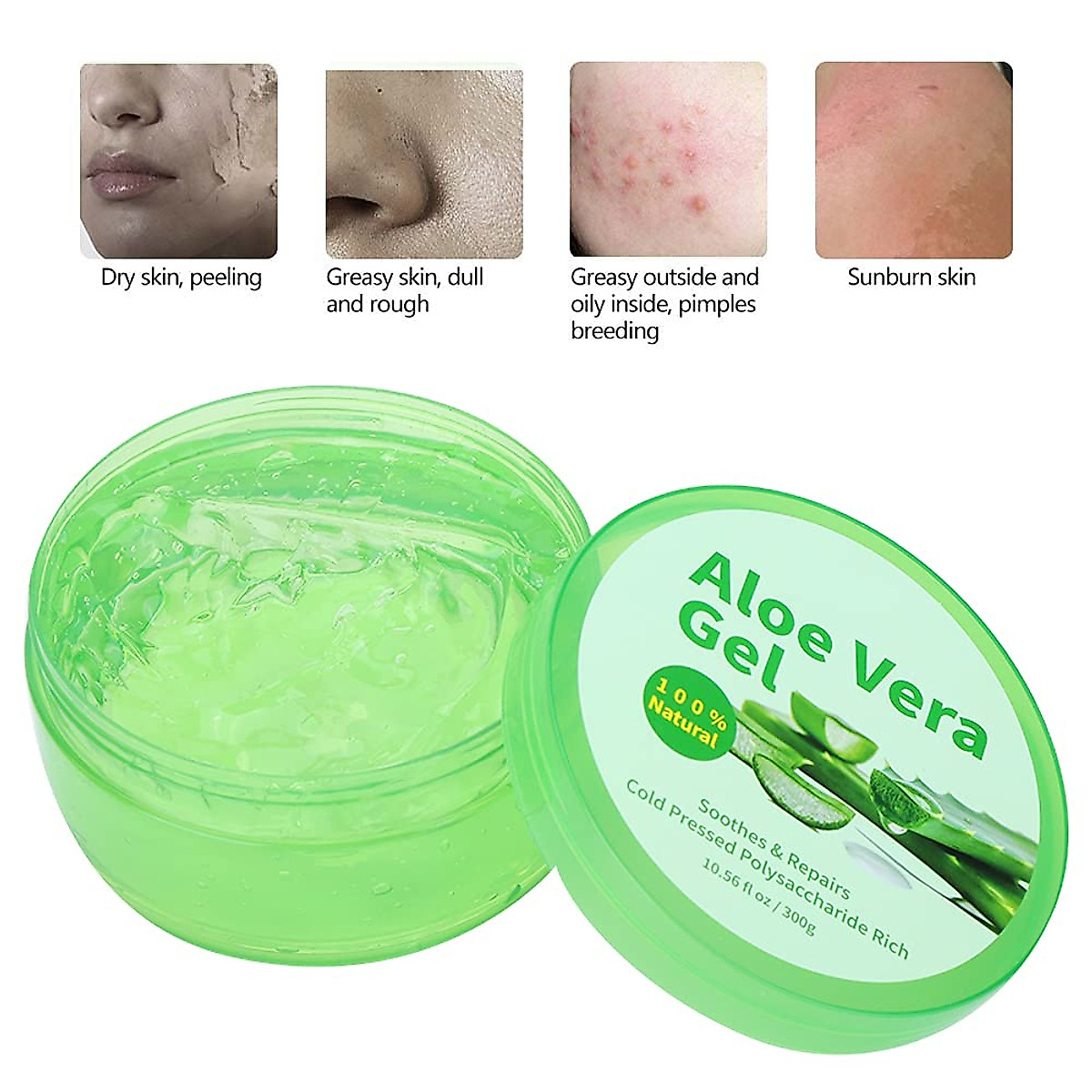 300g Gel Remove Pimples Shrink Pores After-Sun Repair Moisturizing Face Gel Skin Care, Prevent Skin Inflammation