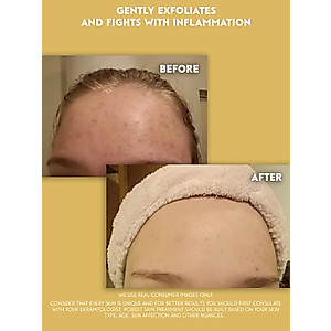 Exfoliating Pineapple Face Milk Serum with Olive Leaf Extract and Allantoin, 1 Fl Oz / 30 ml