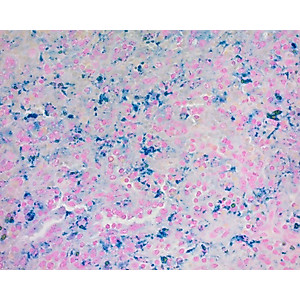 Iron (Prussian Blue) Stain Pack, 500ml